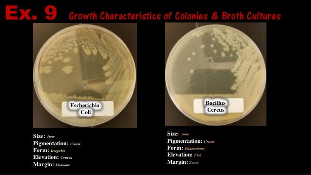 E. Coli Colony Morphology