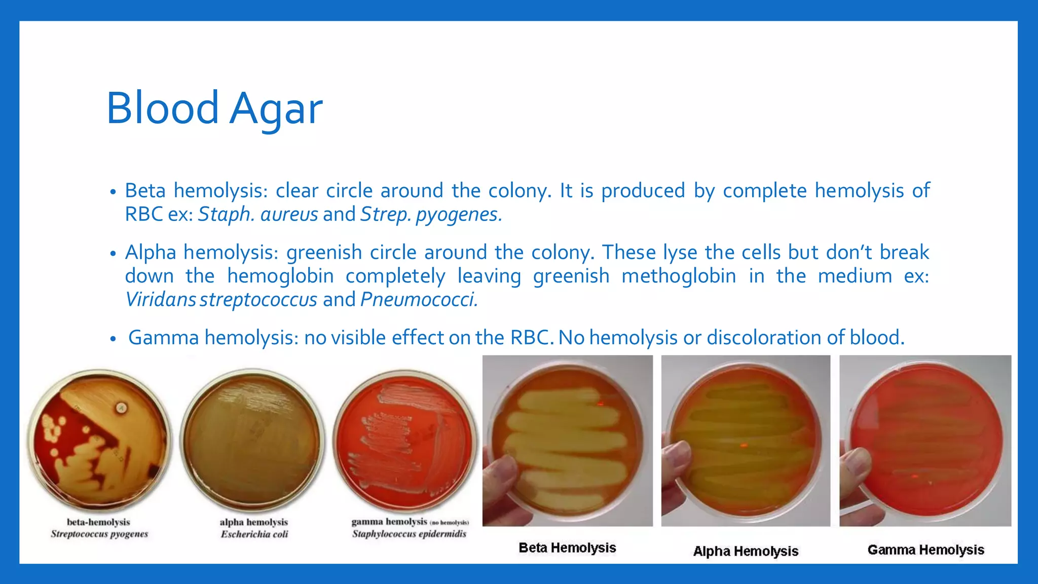 Microbiology lab session 3 Types of Media Used in Microbiology Lab.pdf