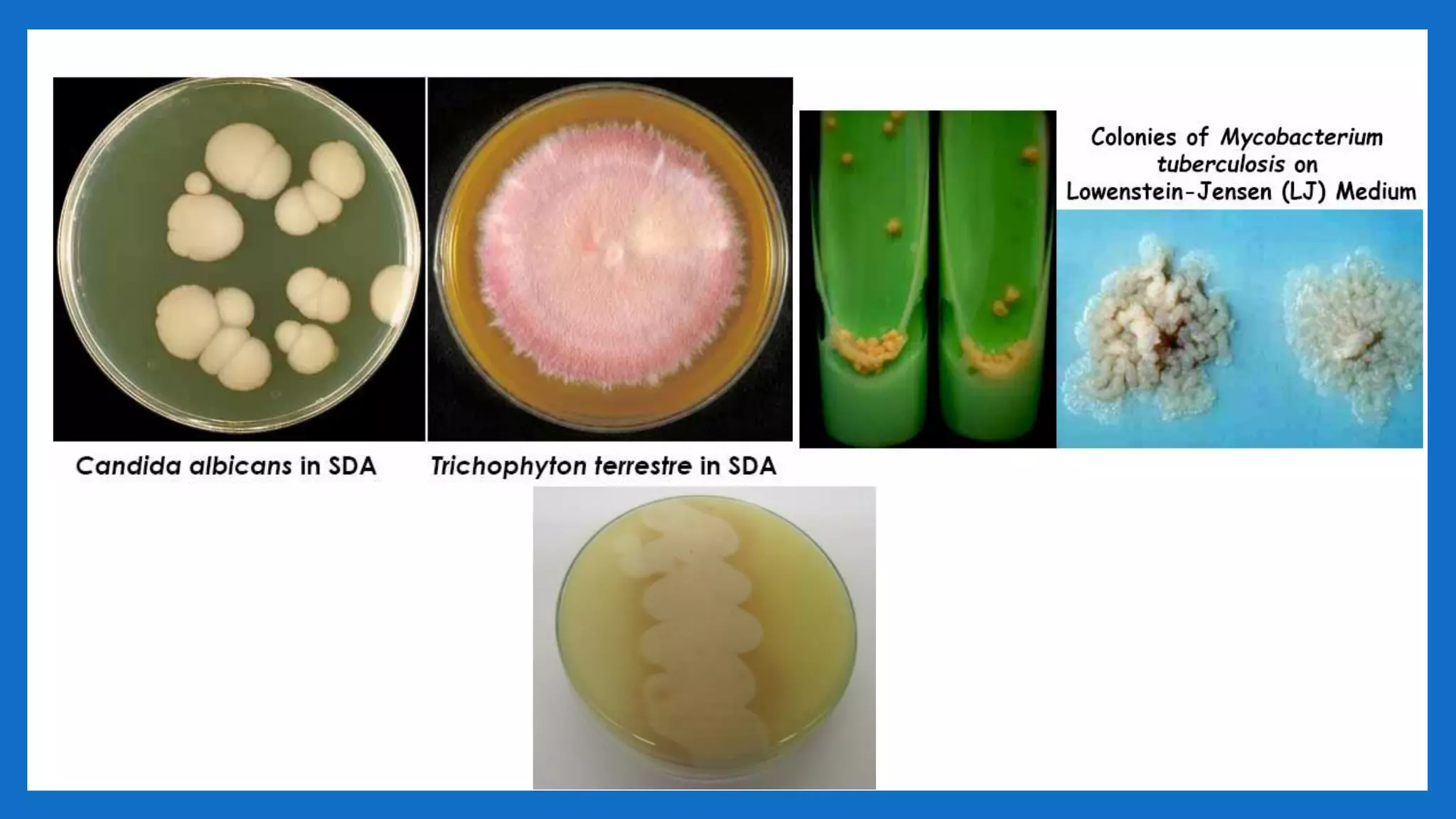 Microbiology lab session 3 Types of Media Used in Microbiology Lab.pdf