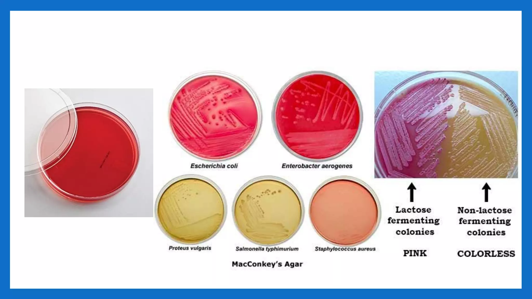 Microbiology lab session 3 Types of Media Used in Microbiology Lab.pdf