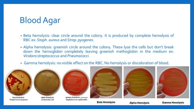 Microbiology Lab Session 3 Types Of Media Used In Microbiology Labpdf 
