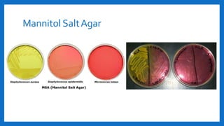 Microbiology lab session 3 Types of Media Used in Microbiology Lab.pdf
