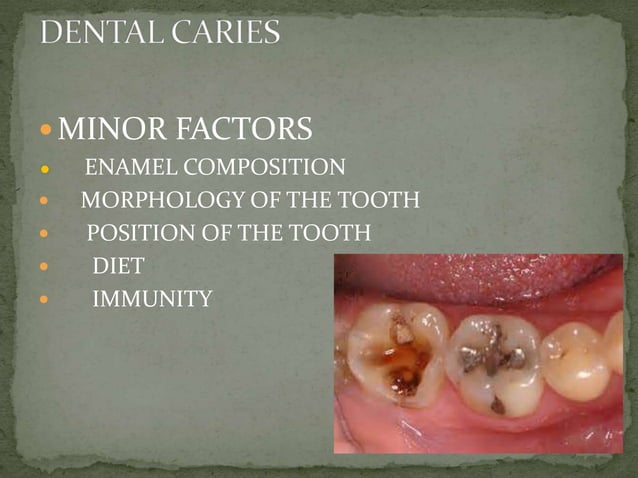 Microbiology of dental caries | PPTX
