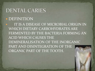Microbiology of dental caries | PPTX