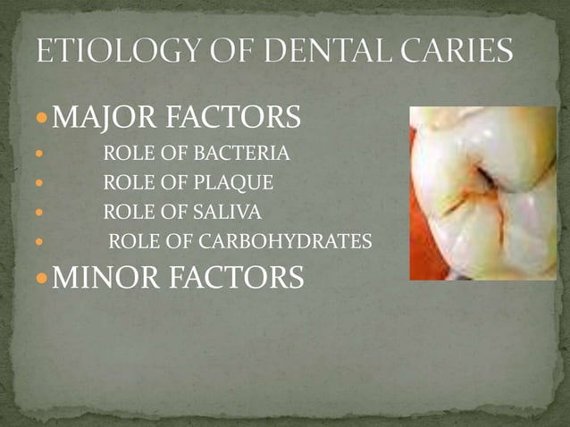 Microbiology of dental caries | PPTX