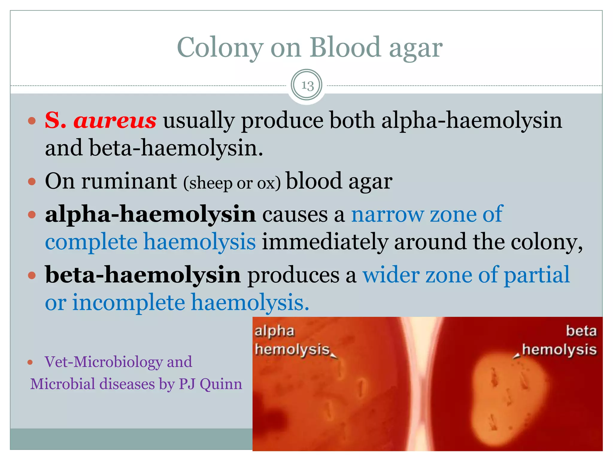 Microbiology of mastitis | PPTX