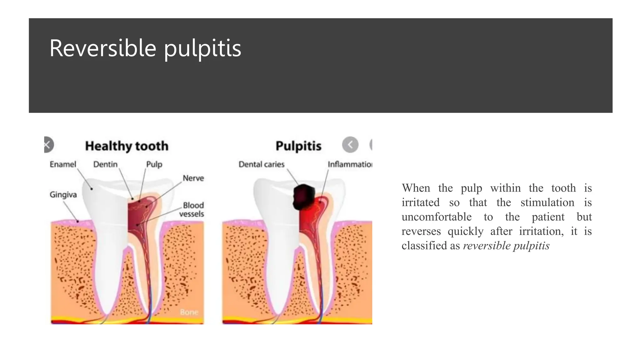 @Microbiology of pulp & periradicular pathosis part 1 2024.pptx