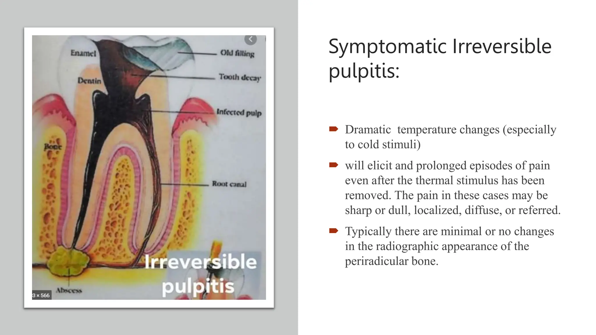 @Microbiology of pulp & periradicular pathosis part 1 2024.pptx