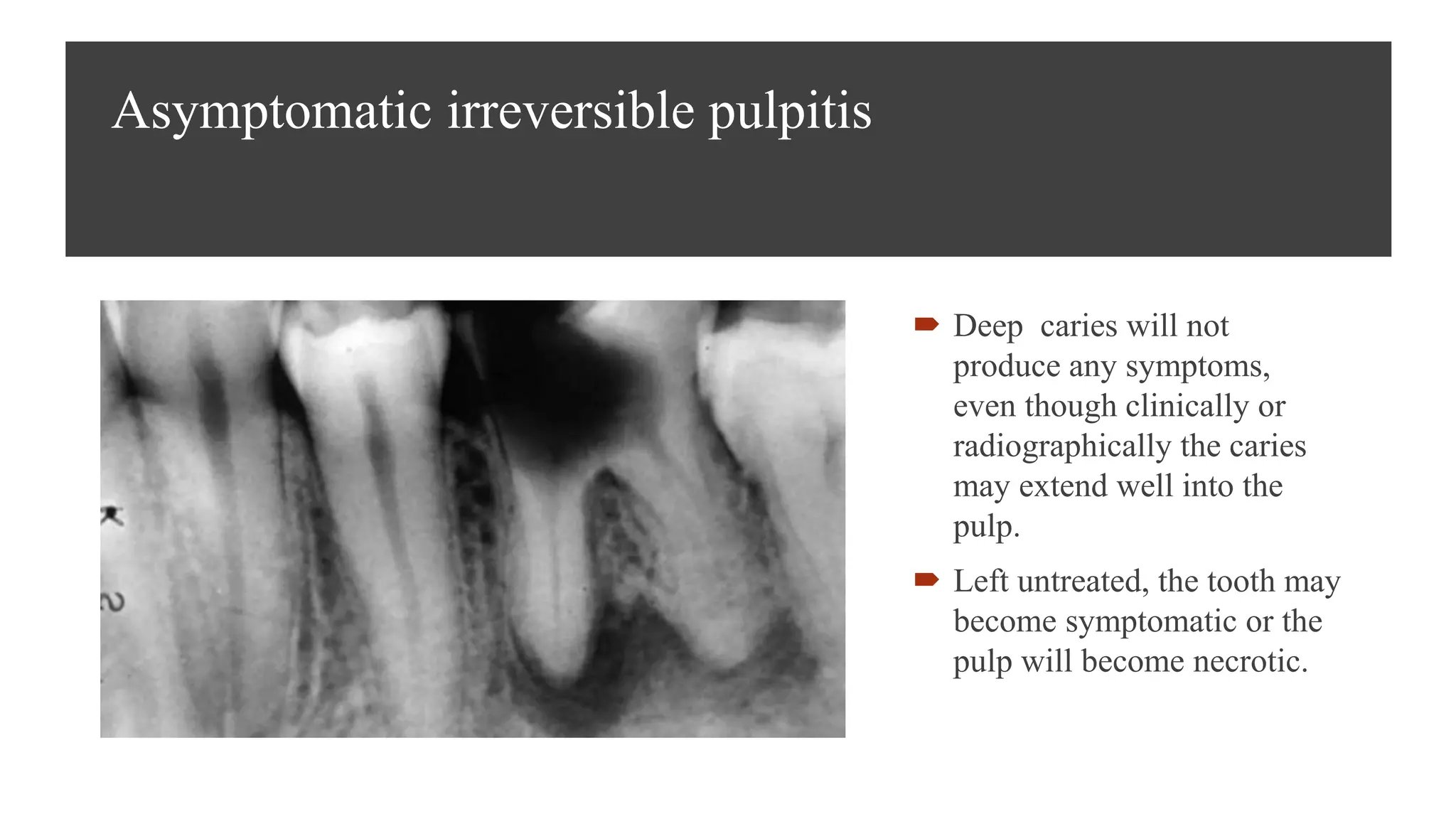 @Microbiology of pulp & periradicular pathosis part 1 2024.pptx