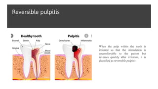 @Microbiology of pulp & periradicular pathosis part 1 2024.pptx