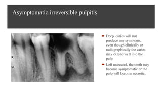 @Microbiology of pulp & periradicular pathosis part 1 2024.pptx