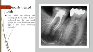 @Microbiology of pulp & periradicular pathosis part 1 2024.pptx