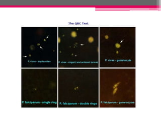 Blood concentration Methods- PBF | PPTX