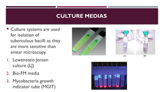 Mycobacteria tuberculosis culture medium | PPTX