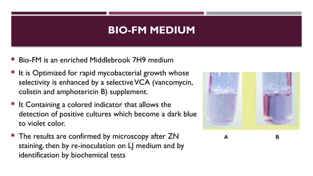 Mycobacteria tuberculosis culture medium | PPTX