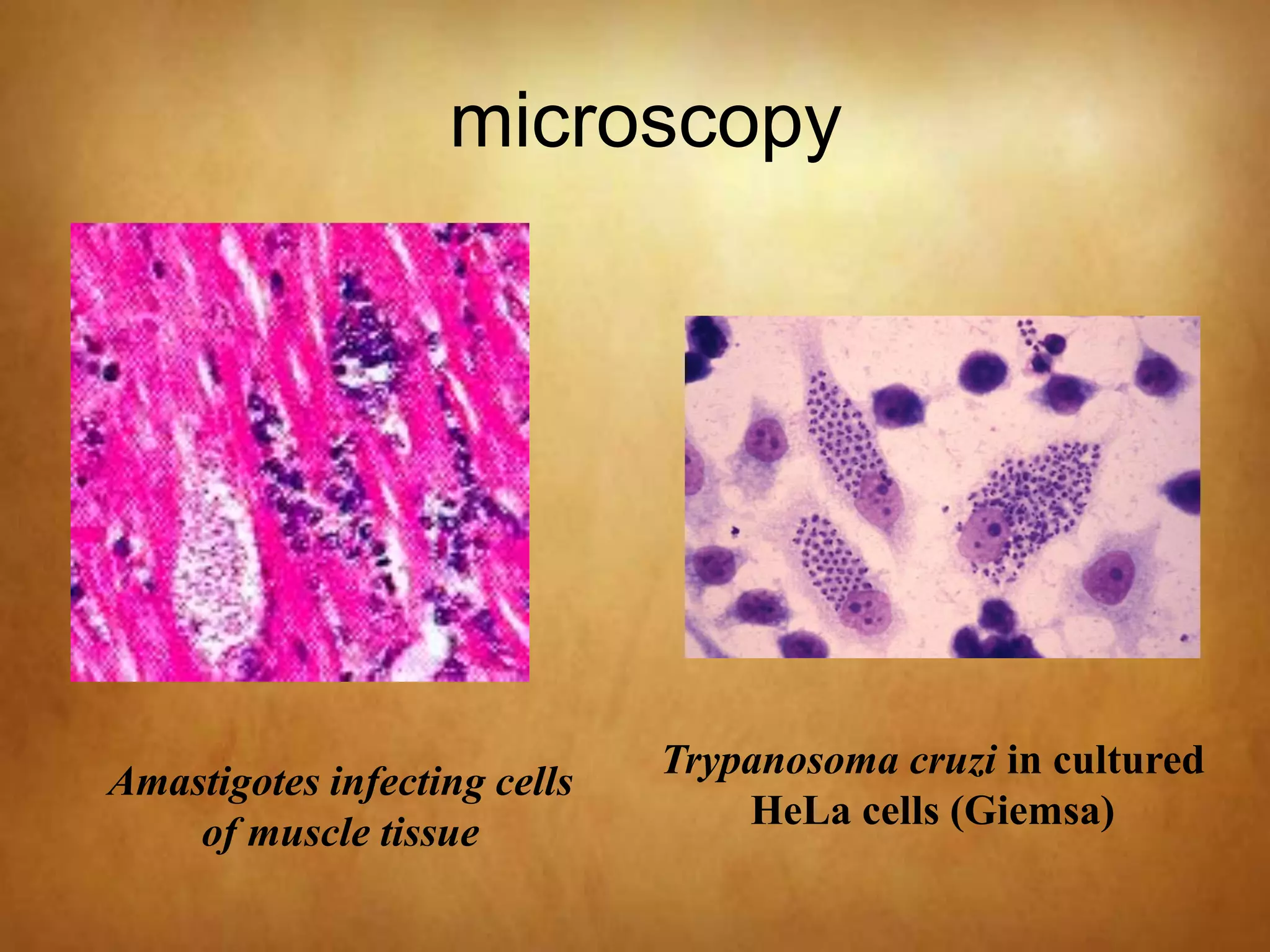 microbiology ppt trypanosoma spp.ppt