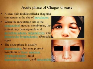 microbiology ppt trypanosoma spp.ppt