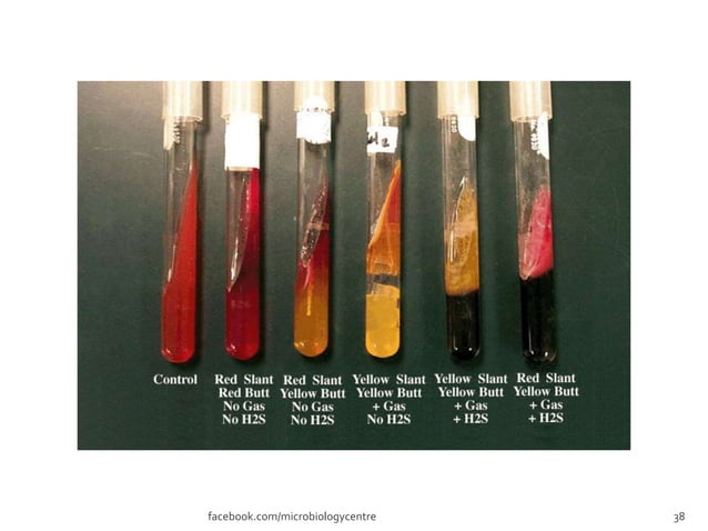 Microbiology practical revision for MBBS : Culture media , Biochemical ...