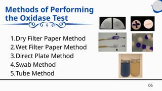 MICROBIOLOGY PRESENTATION on oxidase test for MLT students | PPTX