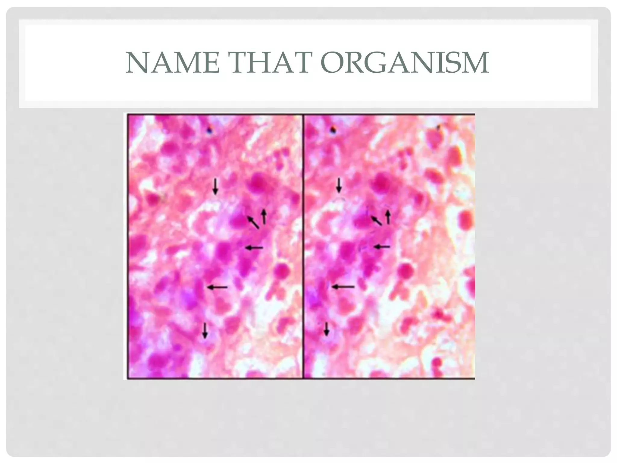Microbiology quiz – pathogens that cause pneumonia | PPT
