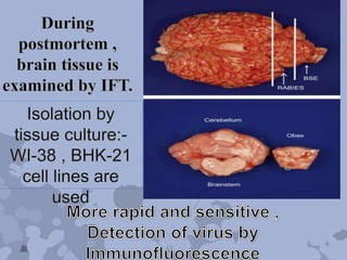 Laboratory diagnoses of RABIES | PPTX