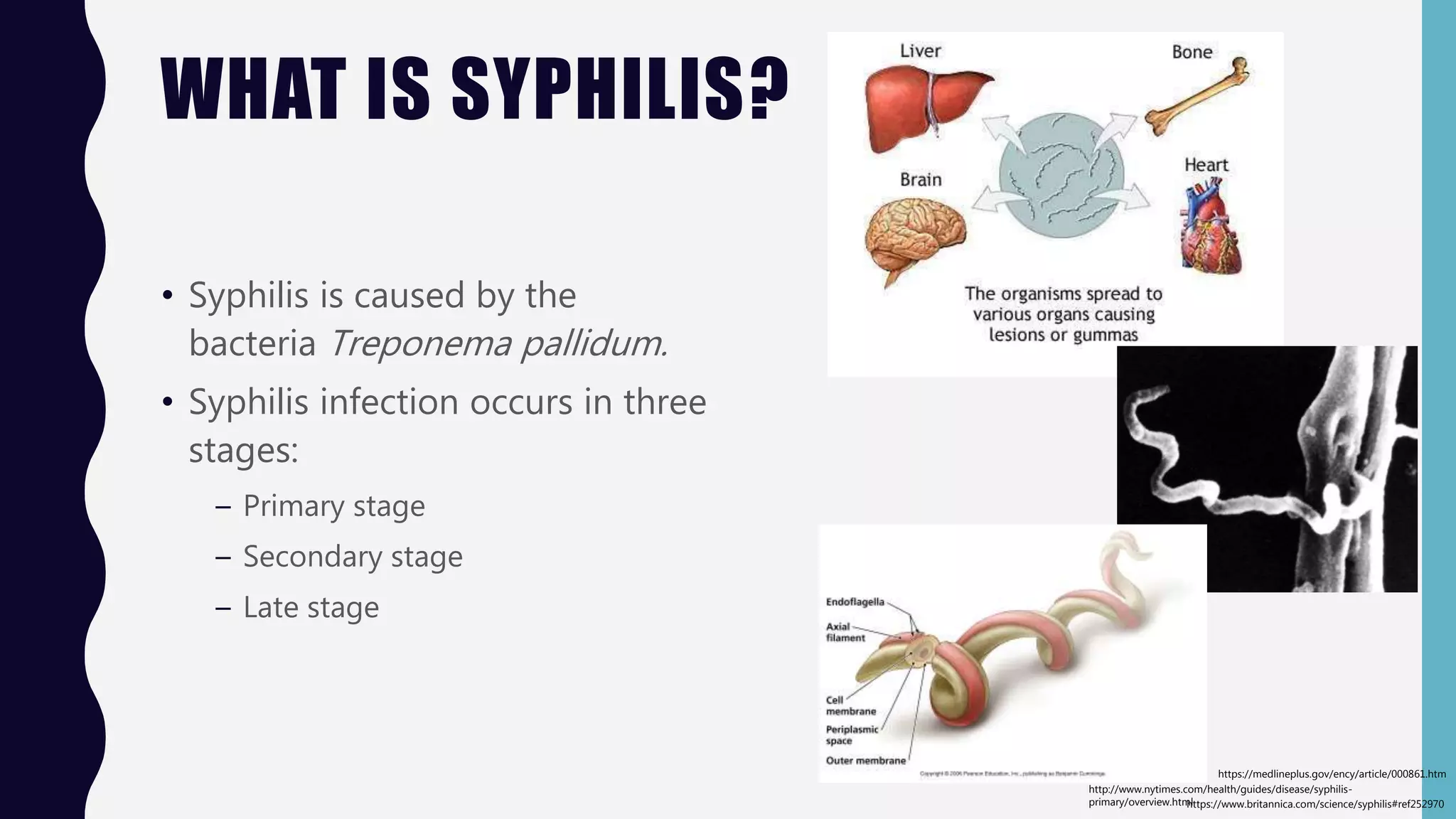 Microbiology syphilis | PPTX