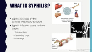 Microbiology syphilis | PPTX