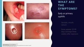 Microbiology syphilis | PPT