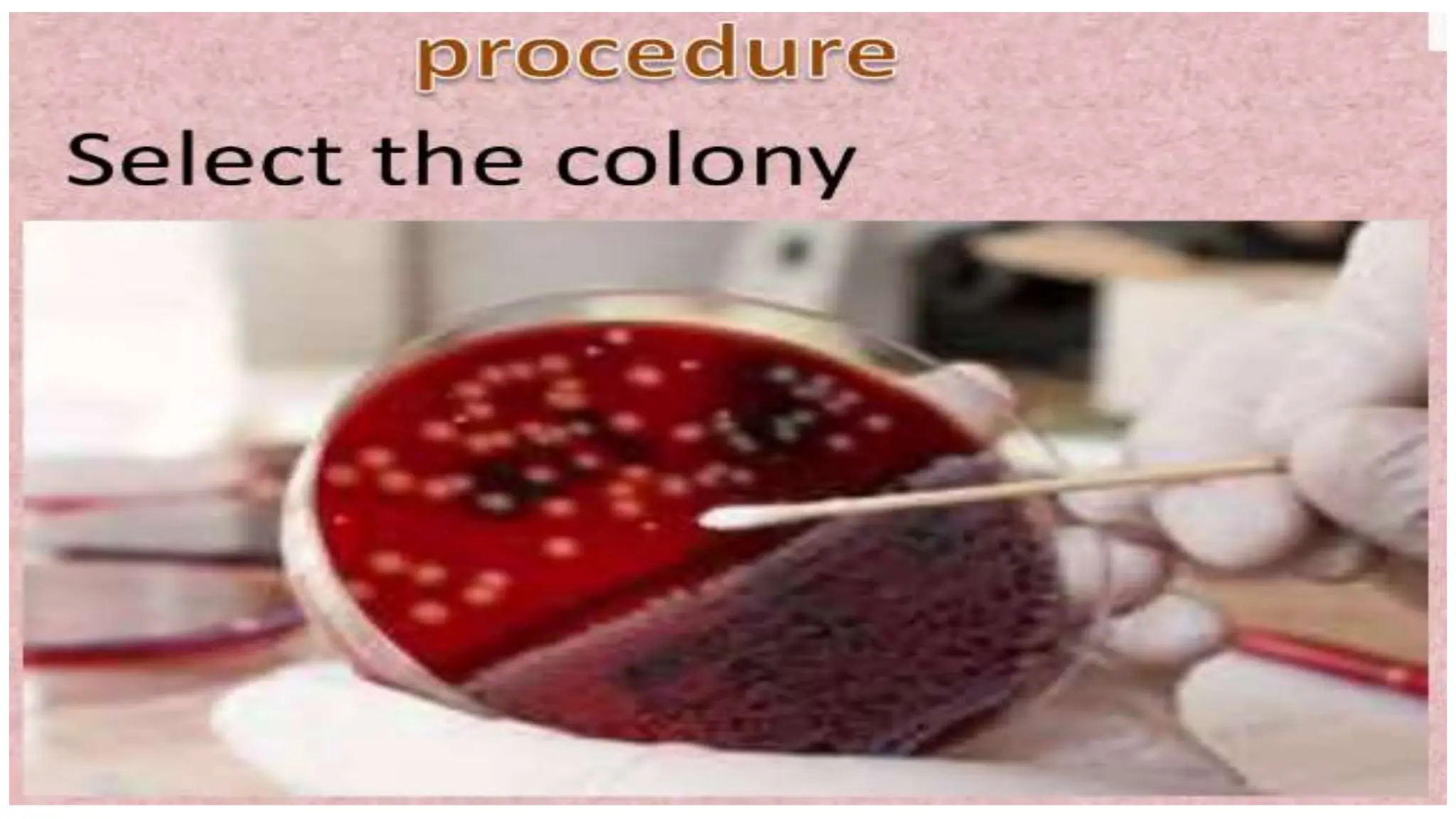 GBSN - Microbiology (Unit 2) Susceptibility of Microbial agents | PPTX