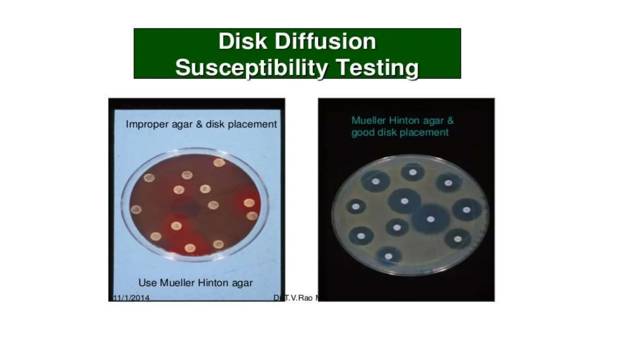 GBSN - Microbiology (Unit 2) Susceptibility of Microbial agents | PPTX