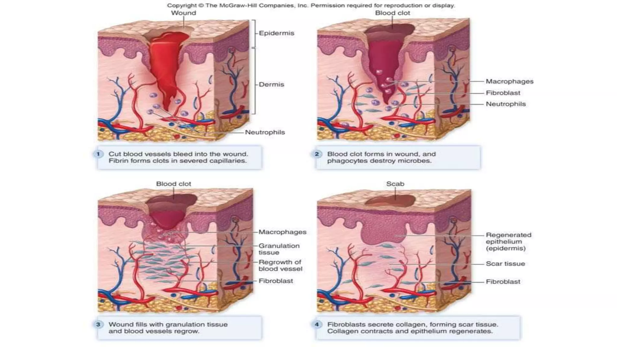 Microbiology, Wound infection.pptx