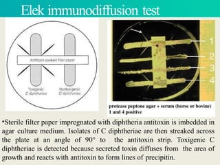 MicrobioM4- Bacteria 6. Diphtheria .pptx