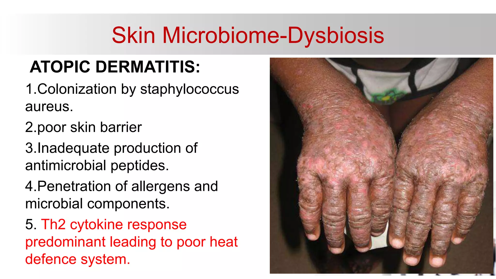 MICROBIOMES AND HUMAN HEALTH.pptx