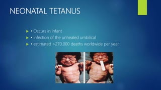 clostridium tetani | PPTX