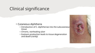Microbiology Presentation - Diphtheriae.pptx