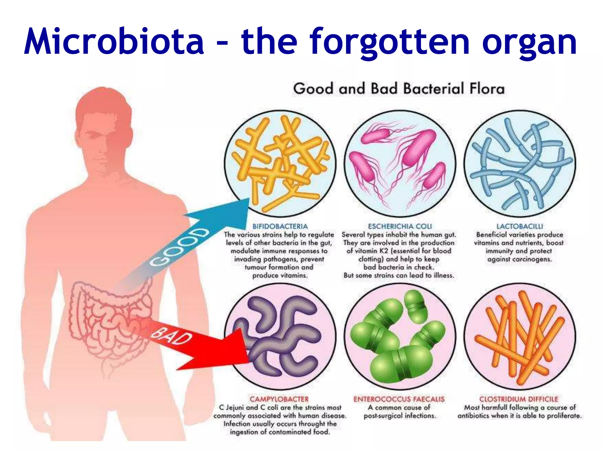 Microbiota Dysbiosis | PPTX