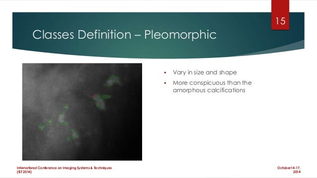 Microcalcification oriented content based mammogram retrieval for bre…