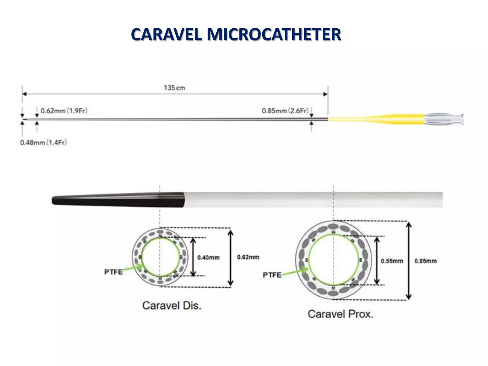 Microcatheters for antegrade and retrograde approach | PPTX