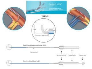 Microcatheters for antegrade and retrograde approach | PPTX