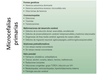Microcefalia | PPTX