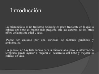 Microcefalia | PPTX