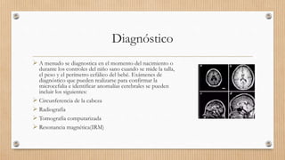 Microcefalia en niños, conocimiento desde cero | PPT