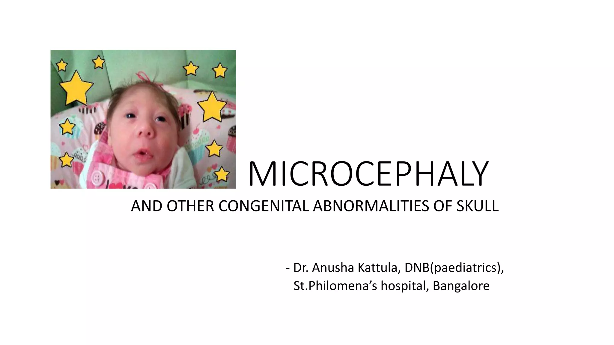 Microcephaly | PPTX