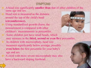 Microcephaly | PPTX | Pregnancy | Reproductive Health