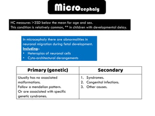 Microcephaly - For medical students | PDF
