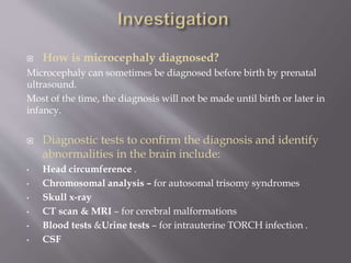 Microcephaly (2).pptx
