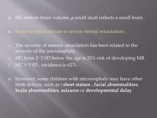 Microcephaly (2).pptx