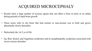 MICROCEPHALY jo.pptx