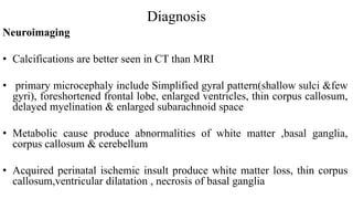 MICROCEPHALY jo.pptx