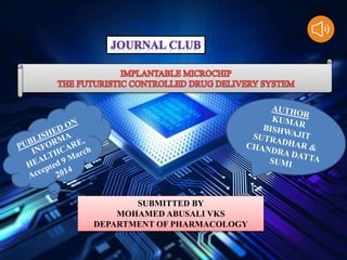 Microchip for cdds | PPTX